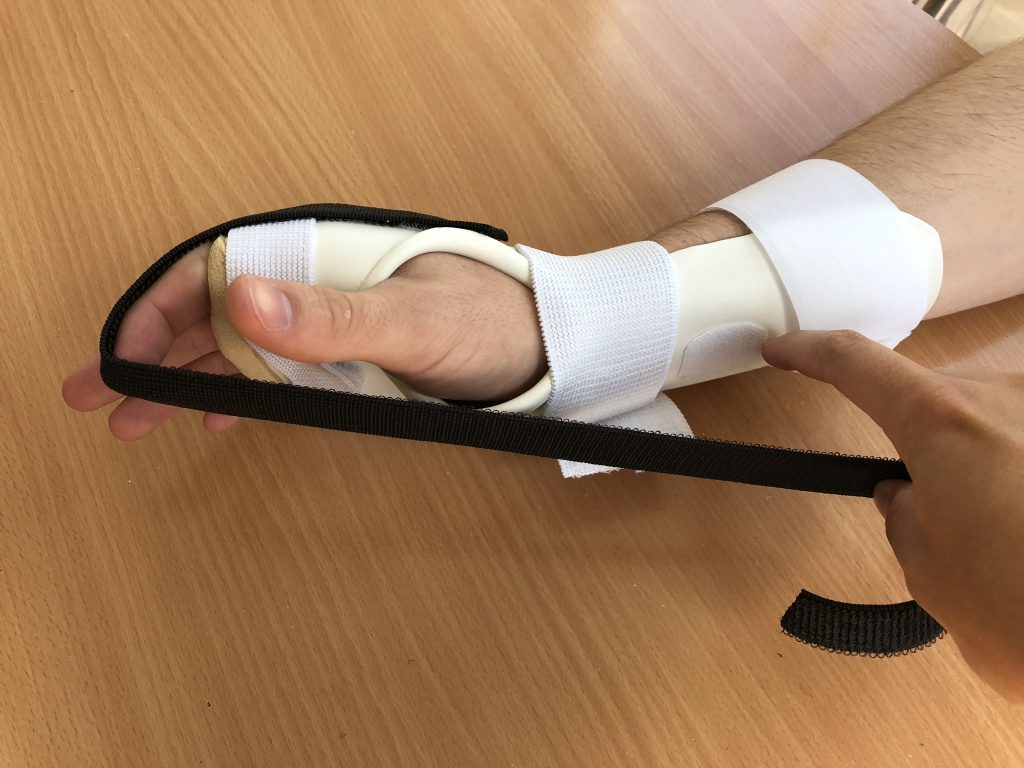 Orthèses en thermoplastique - Institut d'appareillage