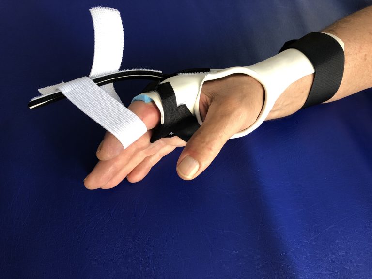 Orthèses Dynamiques - Institut d'appareillage
