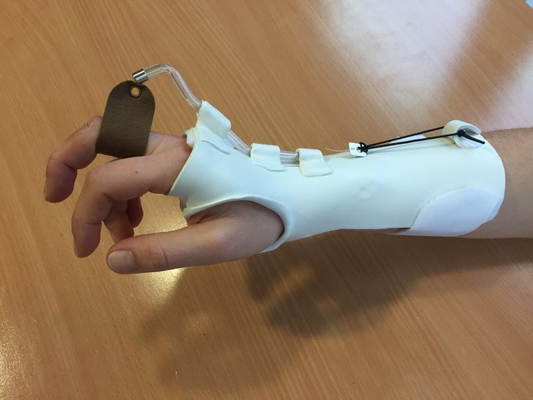 Orthèses Dynamiques - Institut d'appareillage