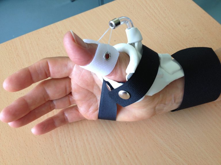 Orthèses Dynamiques - Institut d'appareillage