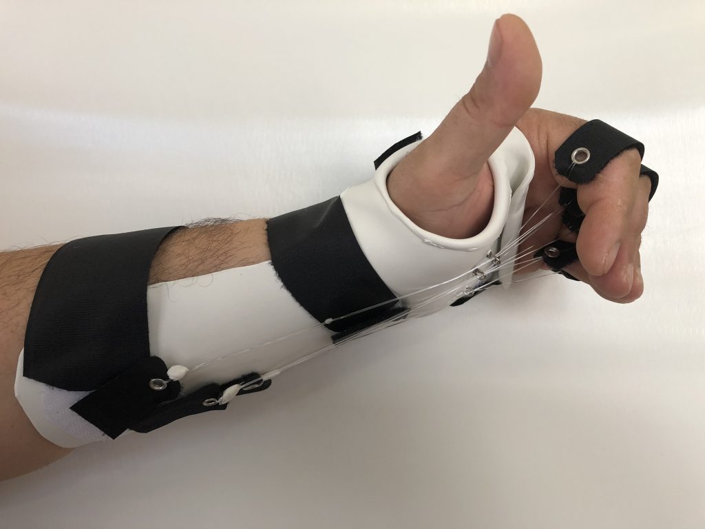 Orthèses Dynamiques - Institut d'appareillage